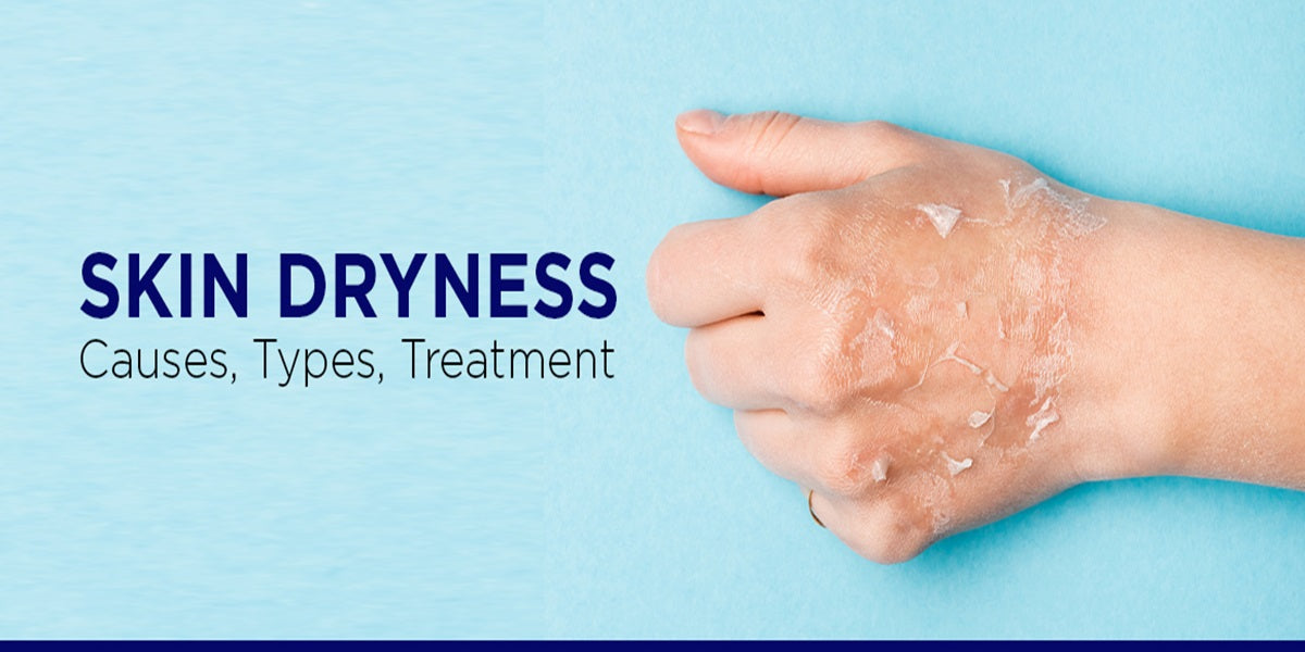 Dry Skin, Eczema, and Allergies in Winter: A Growing Issue – Dawa ...